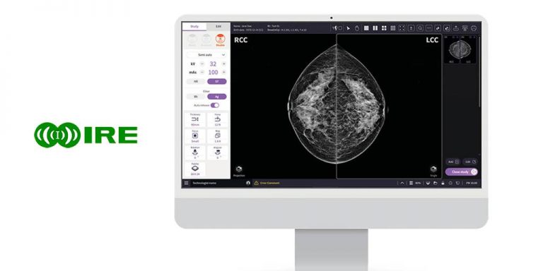 Sistema de Mamografía Digital de Campo Completo | IRE Rayos X